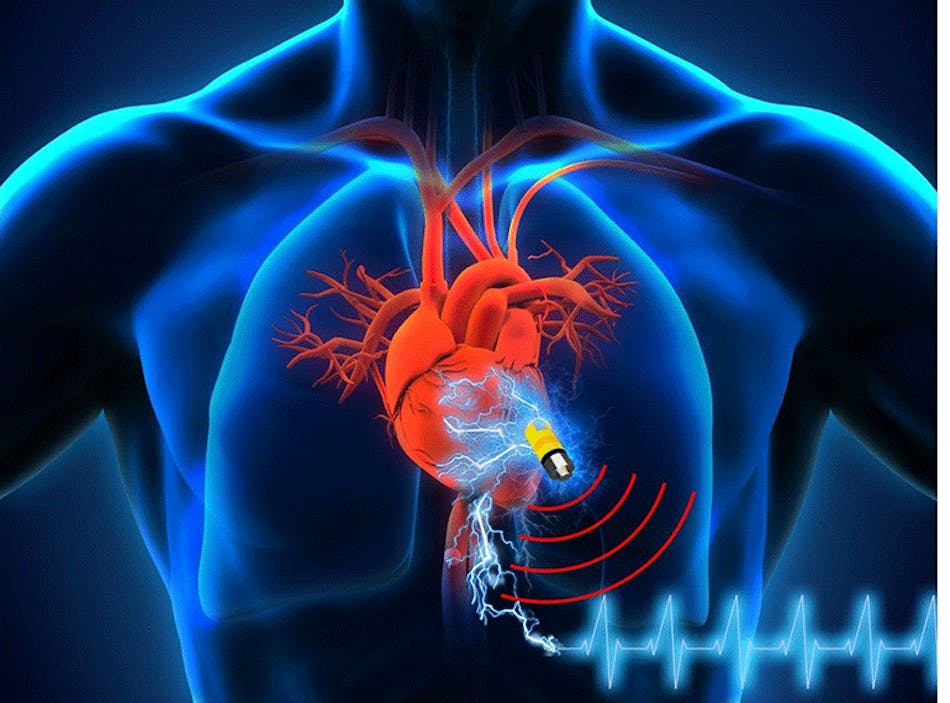 Supercap, Harvester May Let You Power Your Own Pacemaker | Electronic ...