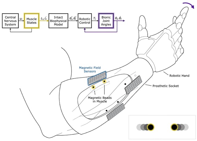 Implanted Magnets, Tracking System Provide Wireless Sensing of ...